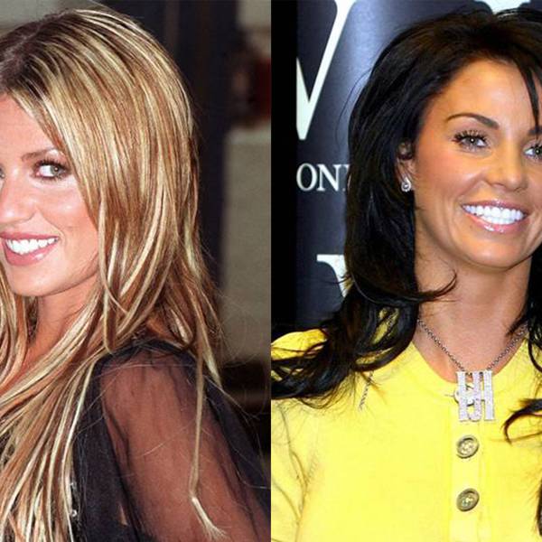 Celebrity Teeth Before & After: Dental Whitening Makeovers | Glamour UK