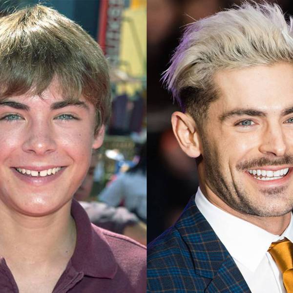 Celebrity Teeth Before & After: Dental Whitening Makeovers | Glamour UK