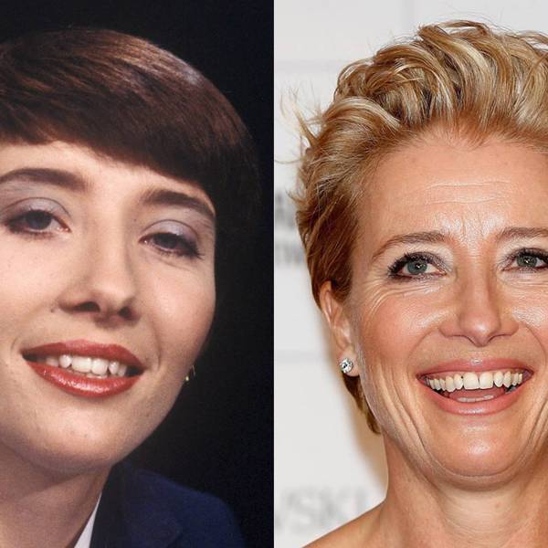 Celebrity Teeth Before & After: Dental Whitening Makeovers | Glamour UK