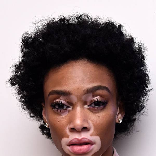 Winnie Harlow hair - best celebrity hairstyles & beauty 2017 | Glamour UK