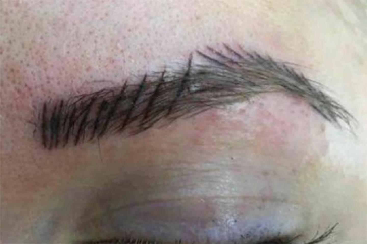 Beauty Salon's Post Showing The Effects Of Bad Microblading Goes Viral ...