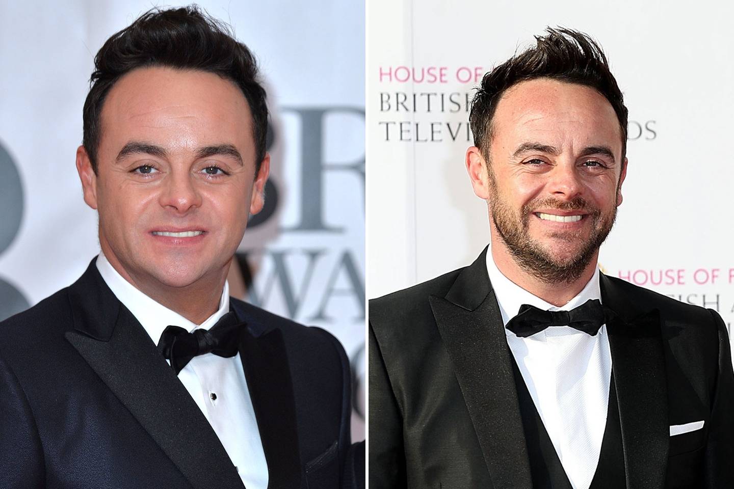 Ant McPartlin beard: his sexy makeover in pictures | Glamour UK