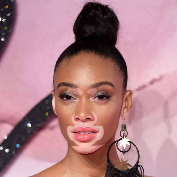 Winnie Harlow hair - best celebrity hairstyles & beauty 2017 | Glamour UK