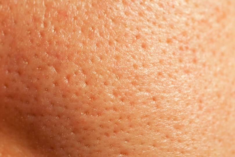 How To Minimise Pores: Tips & Products To Shrink Your Pores | Glamour UK