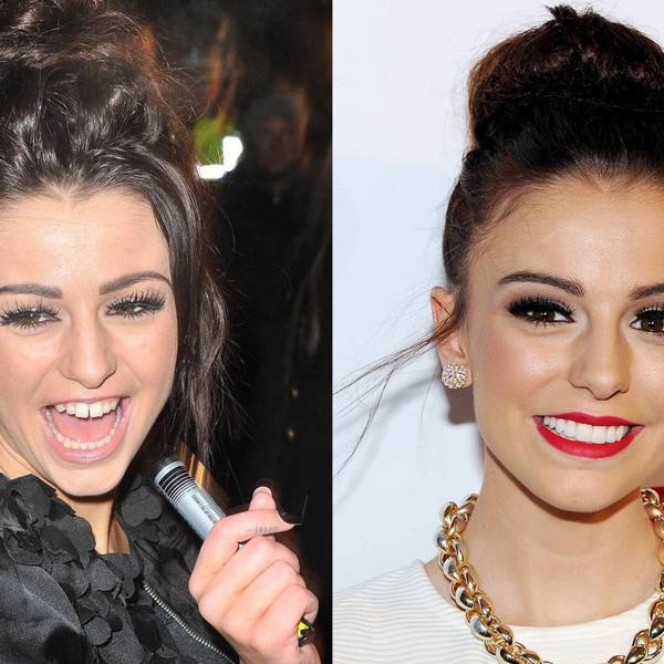 Celebrity Teeth Before & After: Dental Whitening Makeovers | Glamour UK