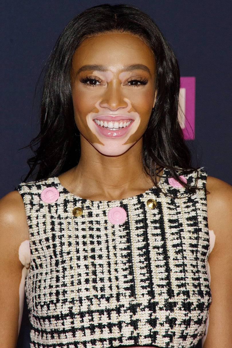 Winnie Harlow hair - best celebrity hairstyles & beauty 2017 | Glamour UK
