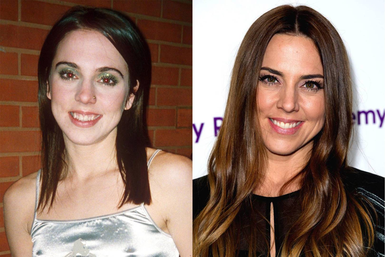 Celebrity Teeth Before & After: Dental Whitening Makeovers | Glamour UK