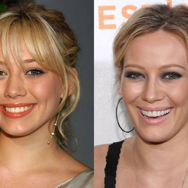 Celebrity Teeth Before & After: Dental Whitening Makeovers | Glamour UK