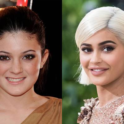 Celebrity Teeth Before & After: Dental Whitening Makeovers | Glamour UK