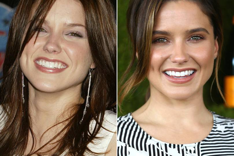 Celebrity Teeth Before & After: Teeth Whitening Makeovers Pictures 2017 ...