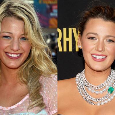 Celebrity Teeth Before & After: Dental Whitening Makeovers | Glamour UK