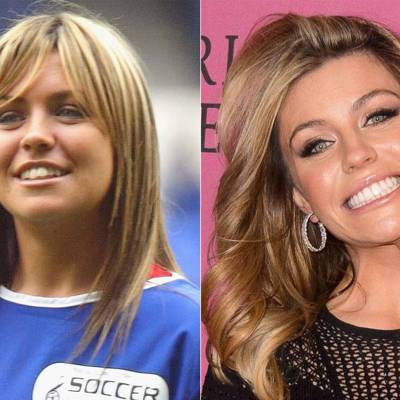 Celebrity Teeth Before & After: Dental Whitening Makeovers | Glamour UK