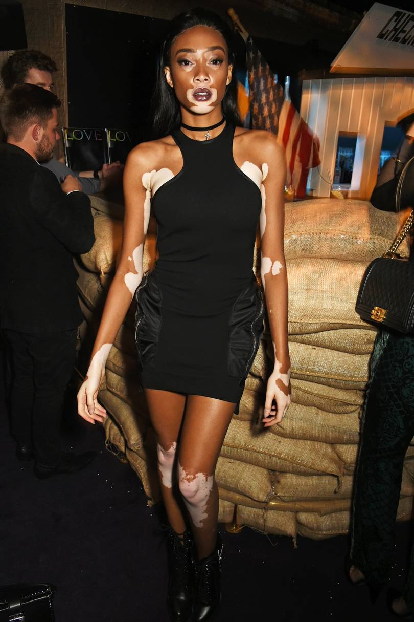 Winnie Harlow GLAMOUR Awards Speech 2017 | Glamour UK