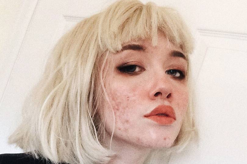 Viral acne Instagram selfies to promote foundation-free skin | Glamour UK