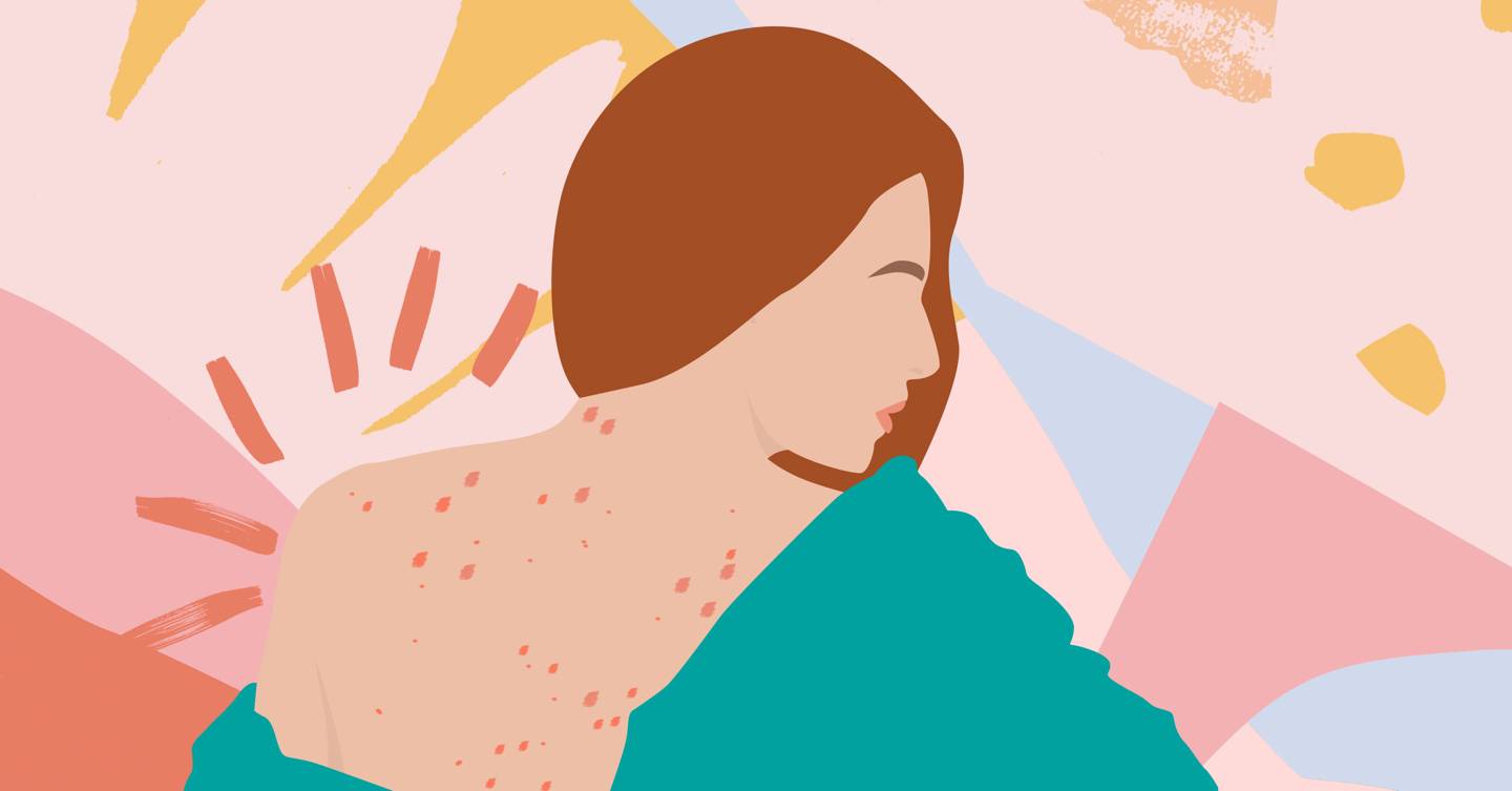 Bacne: How To Get Rid Of Back Acne | Glamour UK