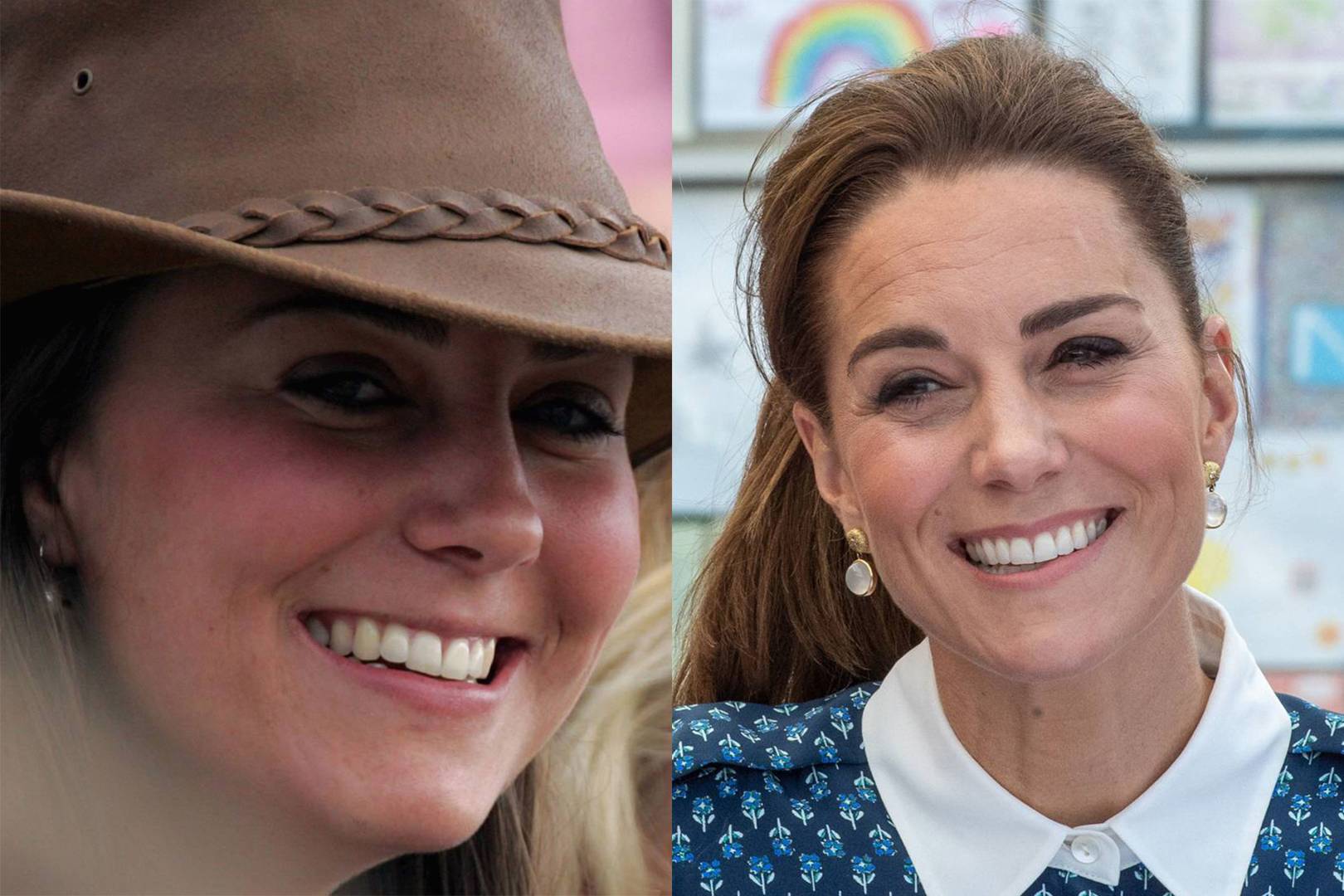 Celebrity Teeth Before & After: Dental Whitening Makeovers | Glamour UK