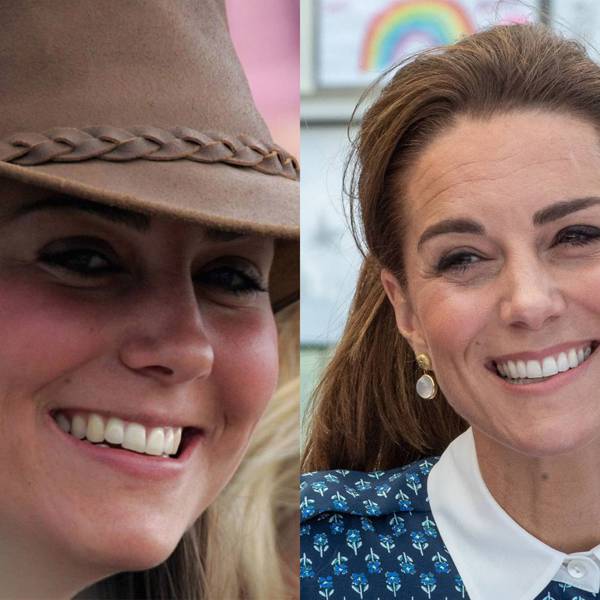 Celebrity Teeth Before & After: Dental Whitening Makeovers | Glamour UK