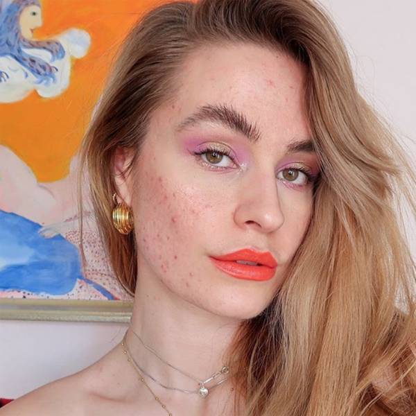 10 Skin-Positive Influencers To Follow | Glamour UK