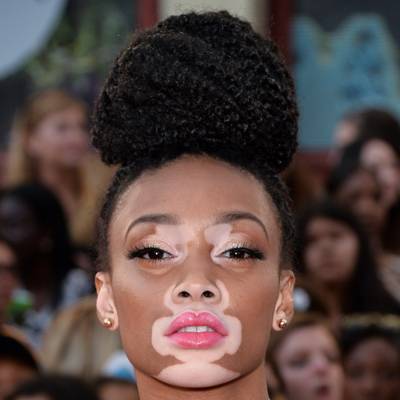 Winnie Harlow hair - best celebrity hairstyles & beauty 2017 | Glamour UK