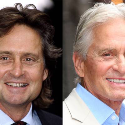 Celebrity Teeth Before & After: Dental Whitening Makeovers | Glamour UK