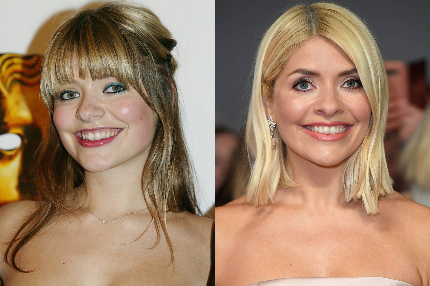 Celebrity Teeth Before & After: Dental Whitening Makeovers | Glamour UK