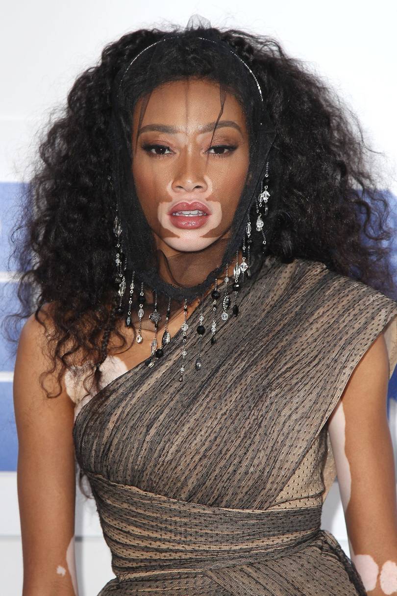 Winnie Harlow hair - best celebrity hairstyles & beauty 2017 | Glamour UK