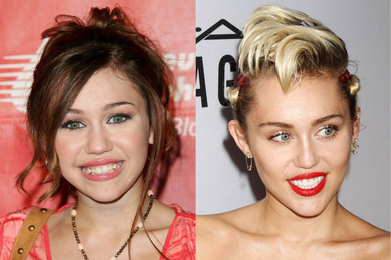 Celebrity Teeth Before & After: Dental Whitening Makeovers | Glamour UK