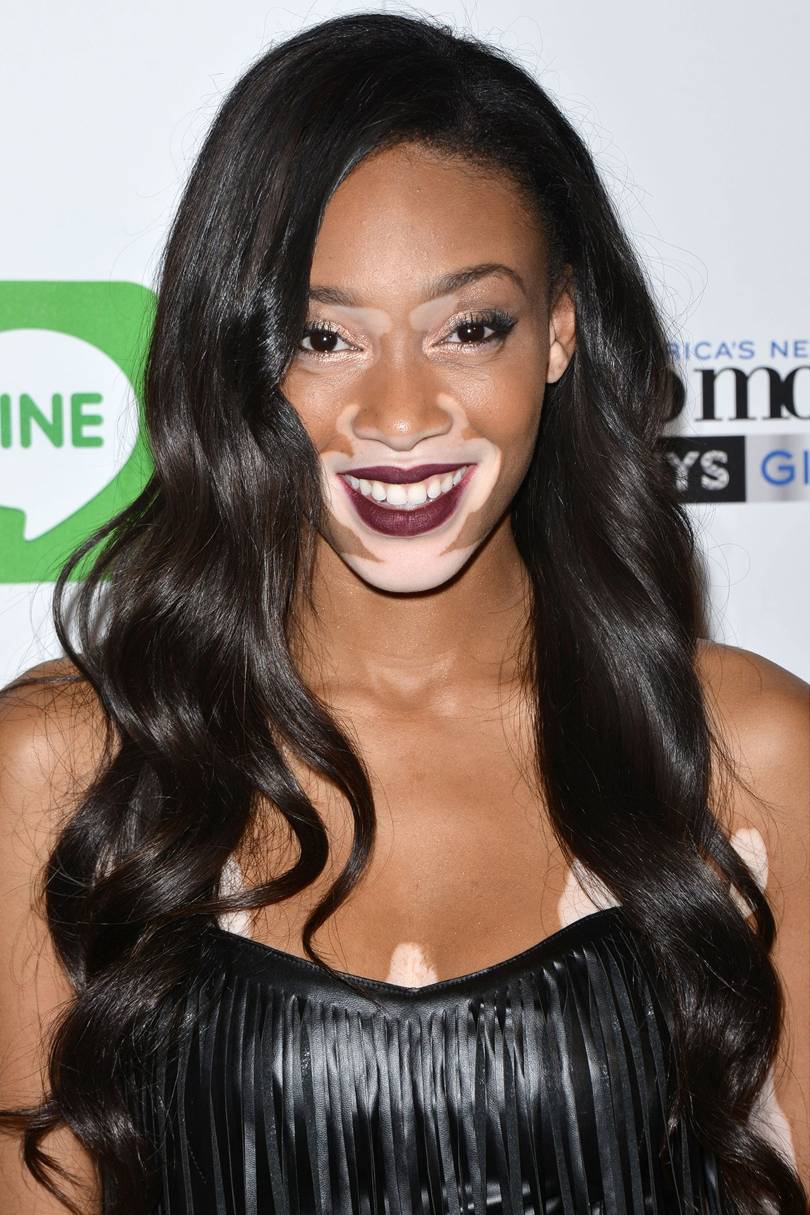 Winnie Harlow hair - best celebrity hairstyles & beauty 2017 | Glamour UK
